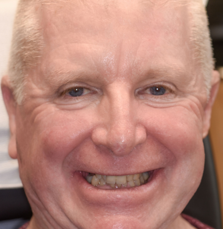 Smile Gallery Near You | Dental Studios